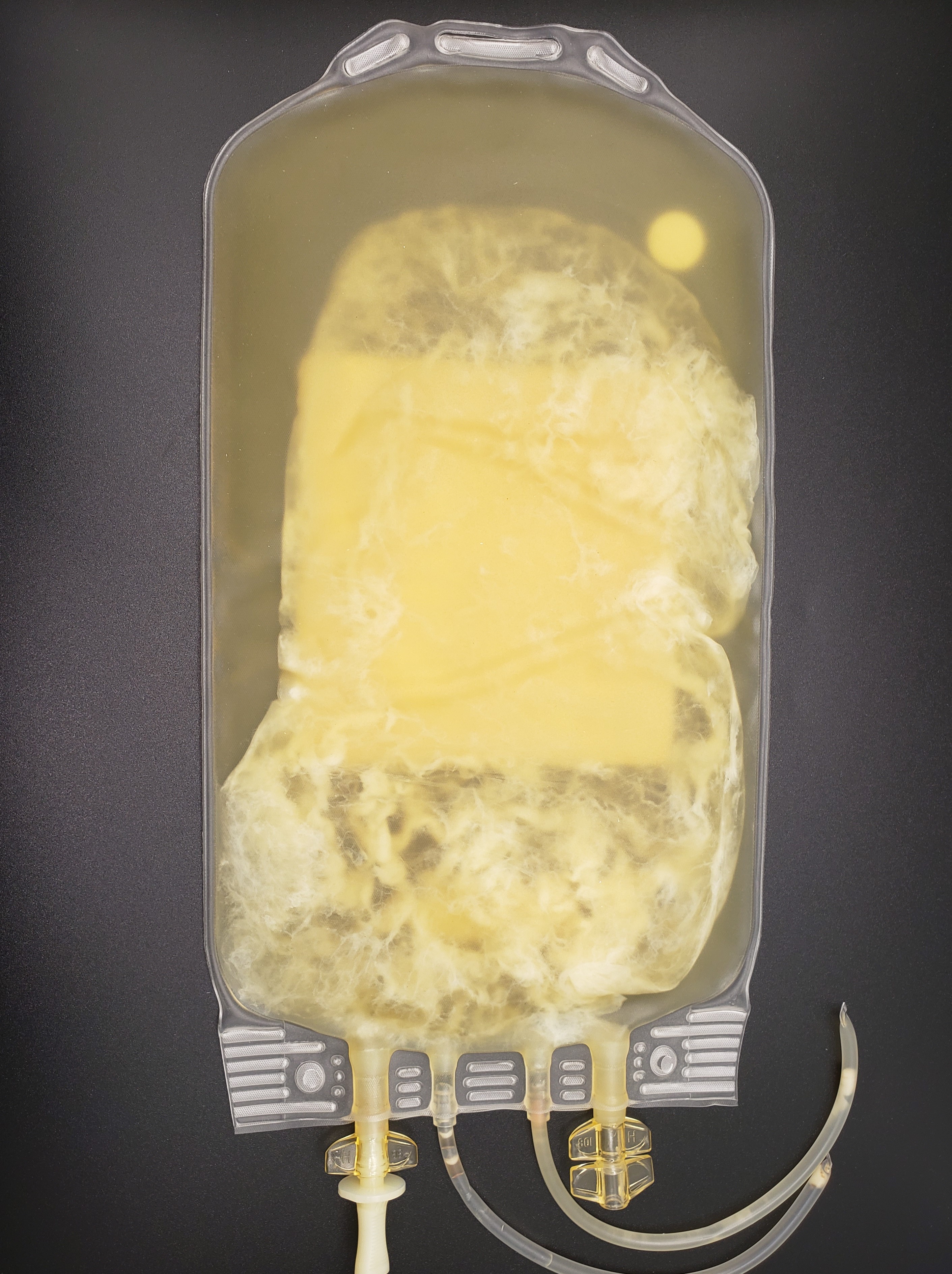 Platelets: Bacterial contamination | Professional Education